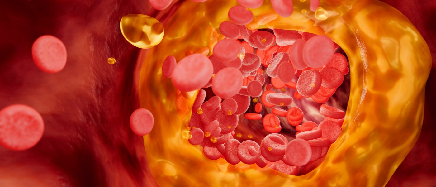 Colesterolo e lipidi possono essere alterati dai disturbi della tiroide ...